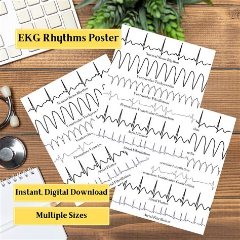 Ekg Poster For Cardiologist Office Sign For Abnormal Heart Rhythm Vfib