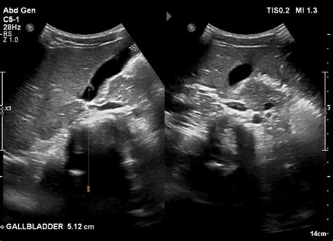 Gallbladder Slide With Labels