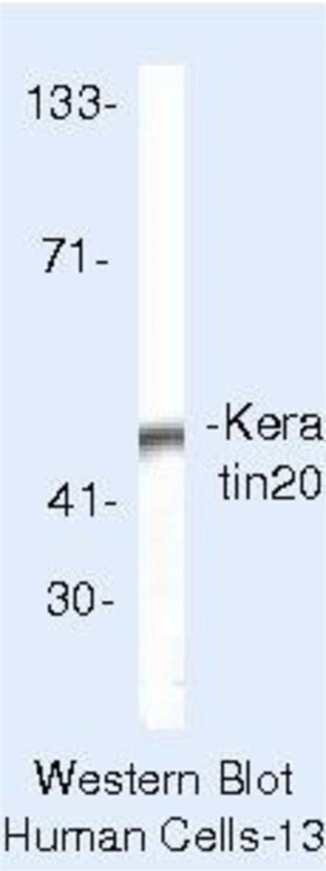 Cytokeratin 20 Monoclonal Antibody Ks208 Invitrogen™ 500 μl