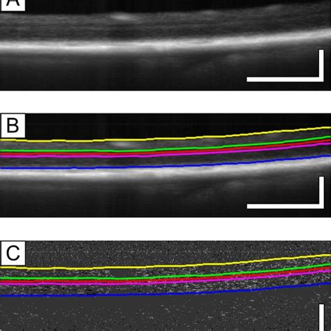 Mouse Brain Diagram Diagram Of Cortex And Hippocampus Sections Of Download Scientific Diagram