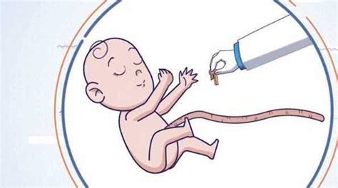 脐带血nk细胞分离及培养全攻略📖