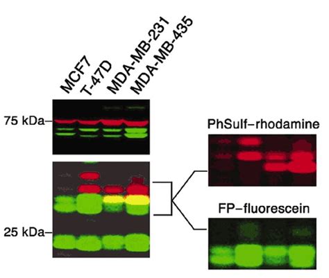 Multiplexing Activity Based Proteomics Probes Human Breast Cancer Cell