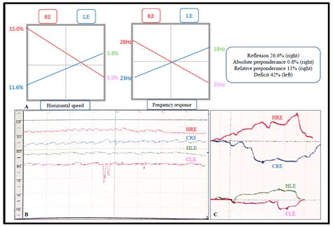 Caloric Test