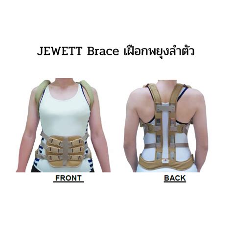 Jewett Brace เฝือกพยุงลำตัว