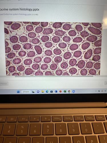 Endocrine And Lymphatic Histology For Practical Flashcards Quizlet
