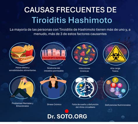 Los Hábitos Ocultos Que Están Dañando Tu Glándula Tiroides Dr Soto