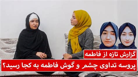 گزارش تازه از فاطمه پروسه تداوی چشم و گوش فاطمه به کجا رسید ؟ Youtube