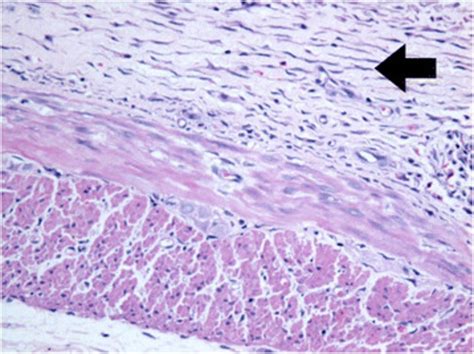 Fibroblast Histology