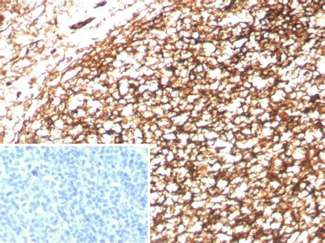 Recombinant Cd35 Cr1 Follicular Dendritic Cell Marker Antibody