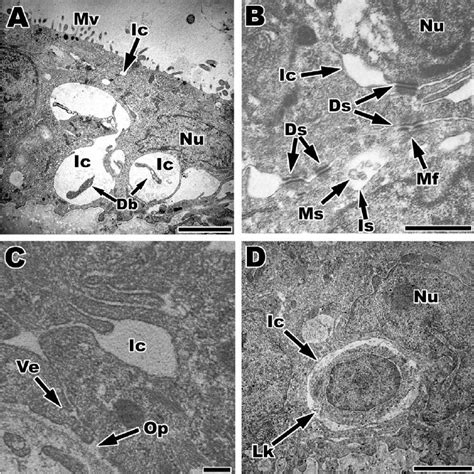 Electron Micrographs Of The Active Rete Testis A Widened Download Scientific Diagram