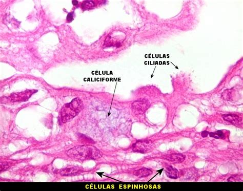 Células Caliciformes