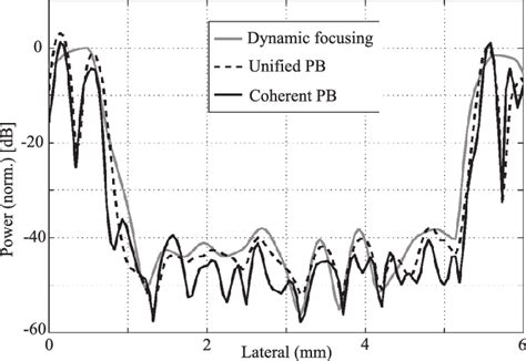 Figure 3 From Ultrasound Pixel Based Beamforming With Phase Alignments
