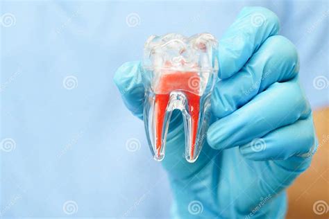 Dental Implant Artificial Tooth Roots Into Jaw Root Canal Of Dental