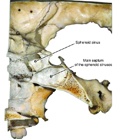 Sphenoid Sinus Anatomy