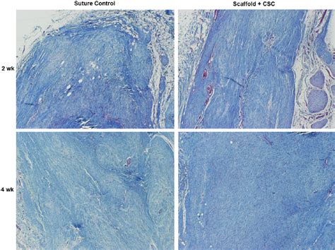 Circulating Stem Cell Augmented Repair Right Vs Control Left At 2