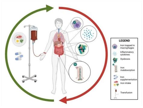 Access Nutrients Inc On Linkedin Iron Deficiency Anemia In Inflammatory Bowel Diseases—a