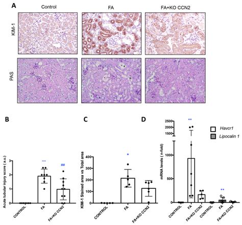 Ccn2 Activates Ripk3 Nlrp3 Inflammasome And Nrf2 Oxidative Pathways