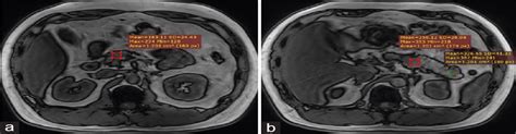 Cross Sectional Comparison Of Magnetic Resonance Imaging And