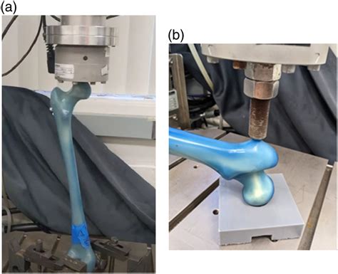Loading Tests Using The Instron Load Cell In A Single Leg Stance And