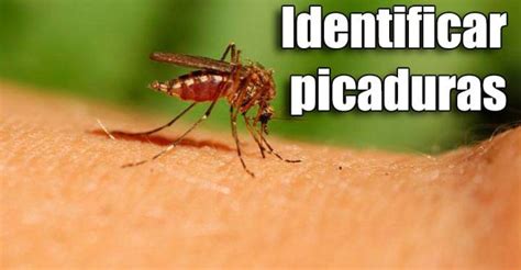 8 Picaduras De Insectos Y Cómo Identificarlas Rczd