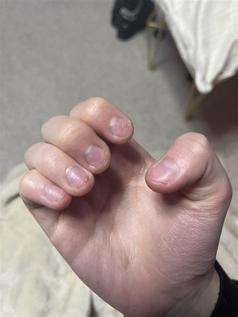 Nail Picking Advice Rnails