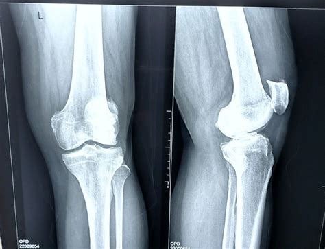 Shabbir Mazahir Pt Posted On Linkedin