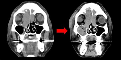Ct Image Initial Left 1 Month Later Right Large Irregular