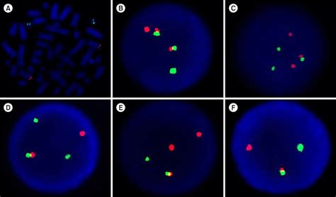 Gene Fusion Probe Creative Bioarray