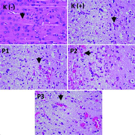 Histological Representation Of Vascularization Events In Rats Brain