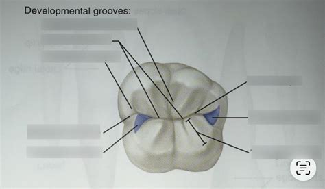 Permanent Posterior Tooth Diagram Quizlet
