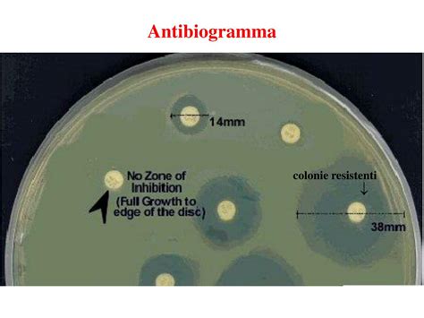 Ppt Diagnosi Di Laboratorio Powerpoint Presentation Free Download
