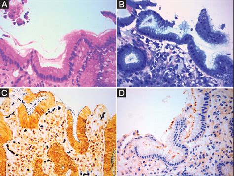 Giemsa Stain Helicobacter Pylori