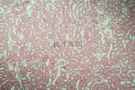 100x 显微镜下的肾皮质高清摄影大图 千库网