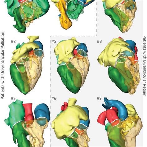 Overview Of All Reconstructed Surface Geometries Using The Same Color Download Scientific