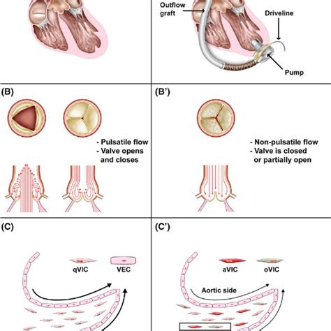 Lv Unloading Pre Ramp Ramp High And Final Follow Up Lvad Speed Download Scientific Diagram