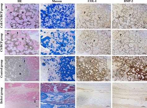 Histological Analysis Of Bone Formation After Bone Defect Download