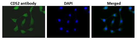 Anti Cd52 Antibody Gtx00743 Genetex