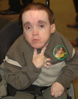 Eric The Midget Howard Stern Official Wiki Fandom