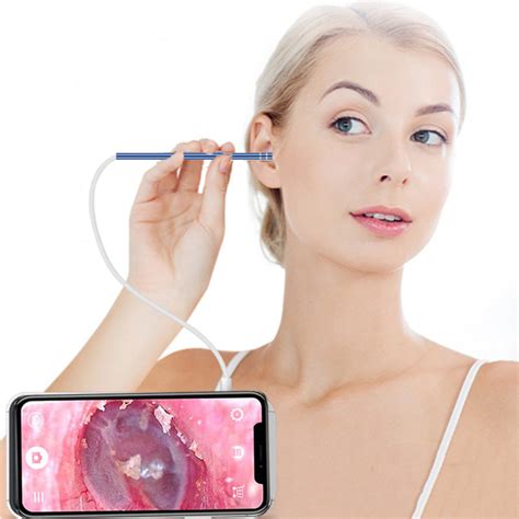 Xgkhut Kamera Endoskopi Pembersih Telinga Otoskop Endoscope Hd Usb