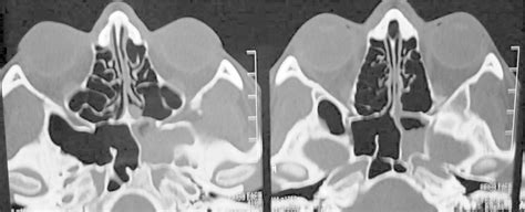 Differential Diagnosis And Treatment Of Isolated Pathologies Of The