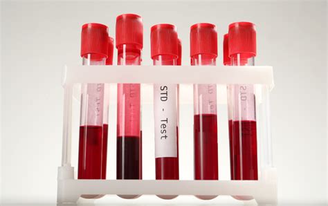 How Often Should I Get Tested For Stds Important Considerations