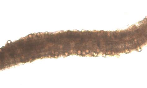 Pythium Diseases Are Not All The Same