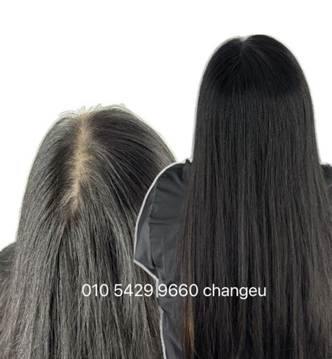 대전여성탈모 해결 가격 산후탈모 네이버 블로그