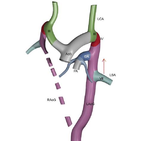 Formation Of Left Sided Aortic Arch Raog Right Dorsal Aorta Laog