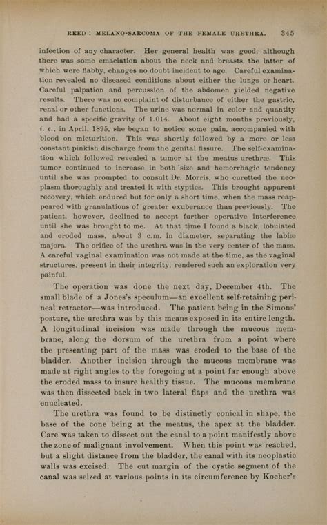 Melano Sarcoma Of The Female Urethra Urethrectomy—recovery Pmc
