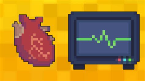 Nstemi Myocardial Infarction Cardiology Geeky Medics