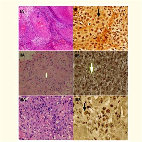 Phases Of Mitosis Hande Stain 100x Crystal Violet Stain 100x A