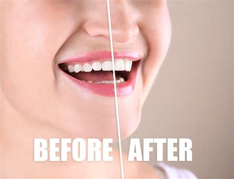 Learning About Treating Periodontal Disease Encinitas Ca