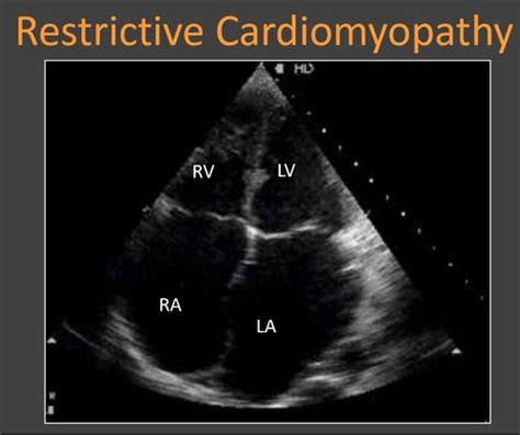 Cmo Restrictive Quiz Flashcards Quizlet