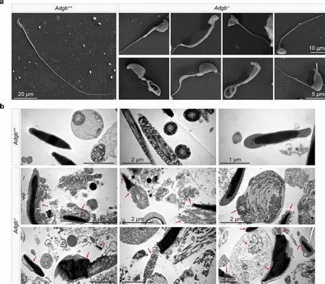 Ultrastructural Assessment Of Sperm In Adgb Mice A Scanning